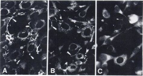 Fibronectin Arrowheads Is Depos Ited As A Pericellular Matrix In