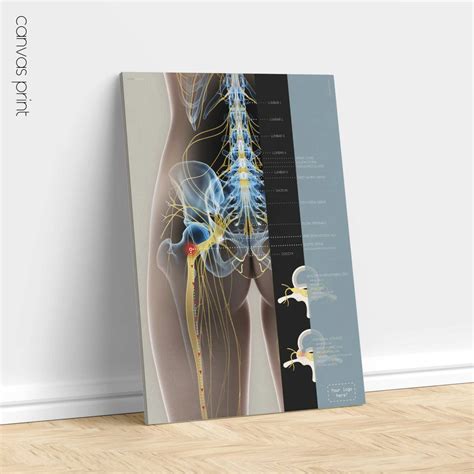Sciatica And Stenosis Educaredesign