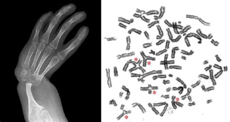 Figure 2 From The Role Of Rad51c On The Fanconi Anemia Pathway In