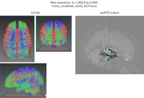 Fiber Tracts Clustered Around Midbrain Issue 927 Yeatmanlab PyAFQ