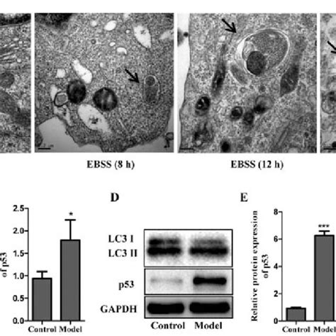 Induction Of Autophagy By Earles Balanced Salt Solution Ebss In