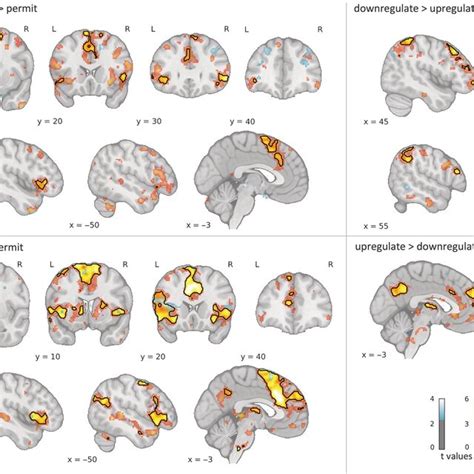Whole‐brain Activations For Controls Hc Red‐yellow And Frontal Lobe Download Scientific