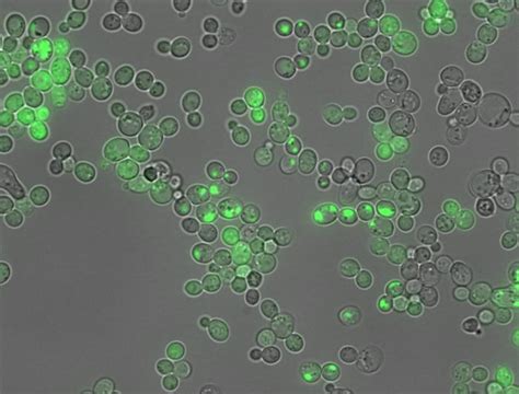 Amyloid Aggregation Inside Cells [image] Eurekalert Science News Releases