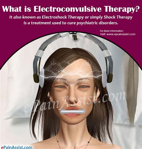 How Is Electroconvulsive Therapy Done Know Its Benefits Side Effects