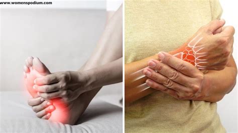 Gout Vs Arthritis A Comprehensive Guide