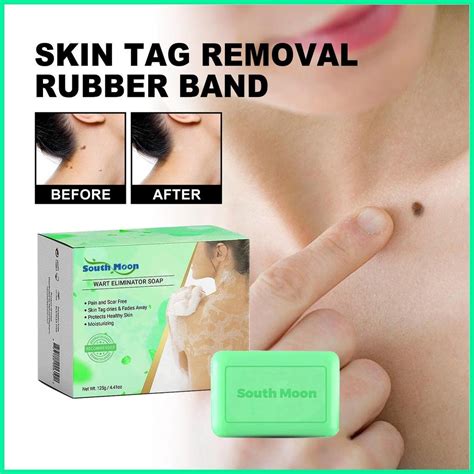 【south Moon】flat Wart Removing Soap Genital Warts Remover Soap Wart
