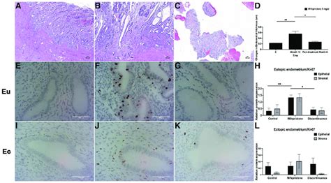 Sections Showing Proliferation Markers In Different Eutopic And Ectopic