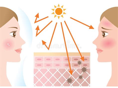 Infographic Skin Illustration Of Sunscreen Protect Skin Against Uv Rays