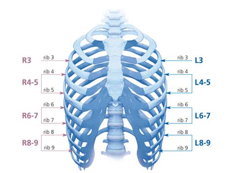 Matrixrib Fixation System