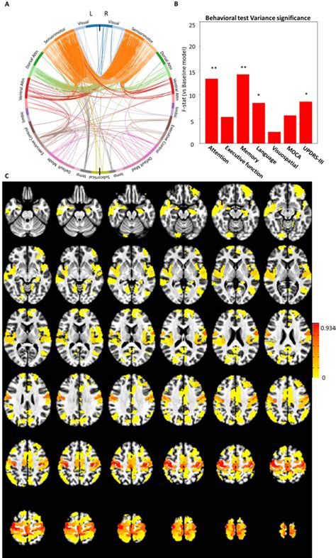 帕金森病轻度认知障碍中功能网络之间的相互作用scientific Reports X Mol