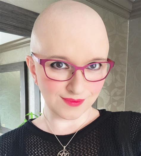 List 90 Pictures How Would I Look With Shaved Head Woman Latest