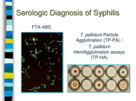 Ppt New Approaches For Infectious Diseases Testing In Clinical Laboratories Powerpoint