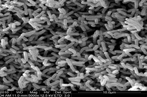 益生乳酸菌lactobacillus Casei Zhang及其相关产品的研究开发