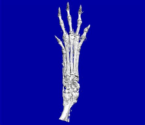 New Mouse Model Of Bone Tumors Elife Science Digests Elife