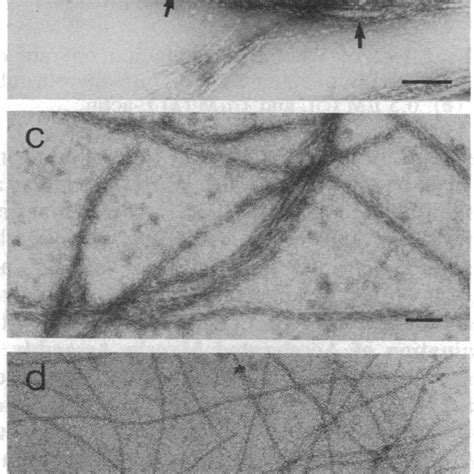 Morphology Of Actin Myosin Assembly Complexes A Bipolar Thick