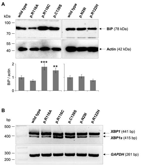 Hereditary Pancreatitis Caused By Mutation Induced Misfolding Of Human