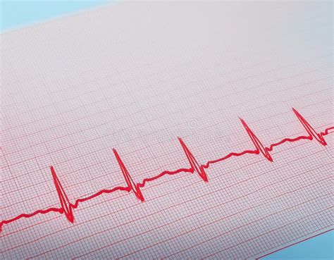 Ecg And Pulse Wave Background Concept Stock Image Image Of Cardiology Health 327812569