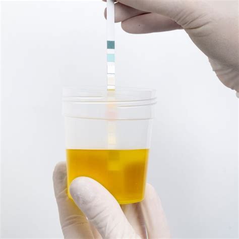 Catecholamines Urine 24h Test Lucid Diagnostic