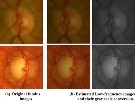initial estimation of low frequency images before applying adaptive