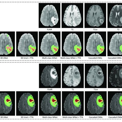 Examples Of Test Time Augmentation Tta Combined With Different Cnns Download Scientific
