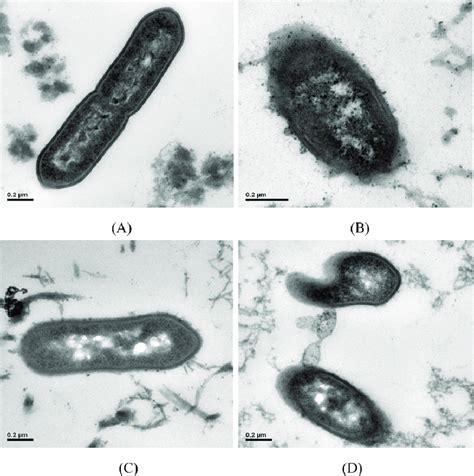 Transmission Electron Microscope Photographs Of L Monocytogenes Download Scientific Diagram