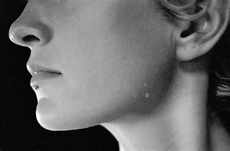 Botox Injections Of The Lateral Pterygoid Muscle In Clenching Bruxism
