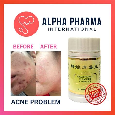 Traditrional Acne Medicine