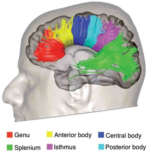 Corpus Callosum Diagram
