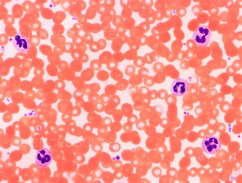 Blood Smear Lm Stock Image Science Source Images