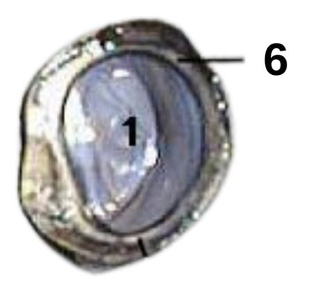 Eyeball Dissection Goat Eye Human Eye Diagrams Flashcards Quizlet