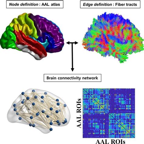 Flowchart Of The Construction Of A Structural Brain Network Based On