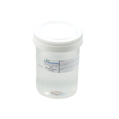 Specimen Container Prefilled 30ml 60ml Lumea Consumables
