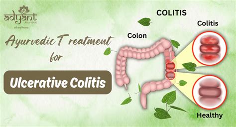 Ayurvedic Treatment For Ulcerative Colitis A Complete Healing Guide