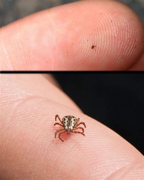 Chiggers Vs Ticks