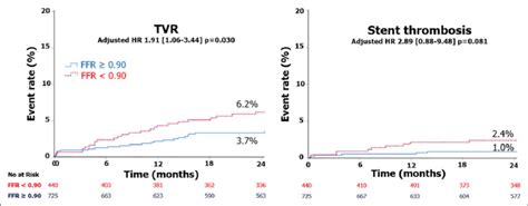 Kaplan Meier Curves For Target Vessel Revascularization Tvr And Stent