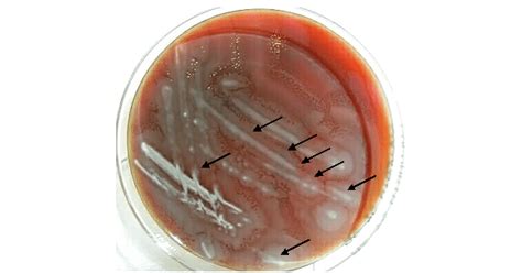 Proteus Mirabilis Microbiology Class