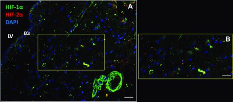 The Svz Niche Is Hypoxic Transcription Factors Hif 1α And Hif 2α Are