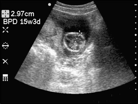 Trauma Radiology Key