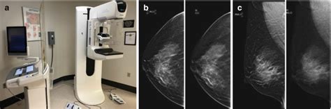 Breast Imaging Springer Nature Link