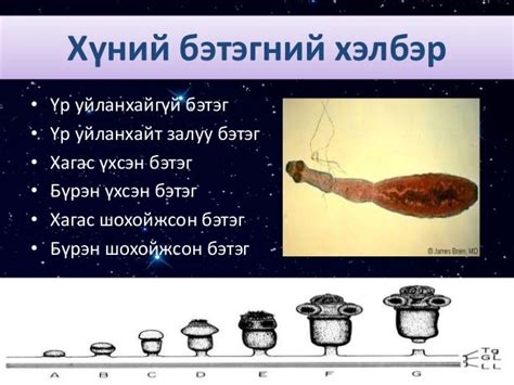 Элэгний голомтот эмгэг