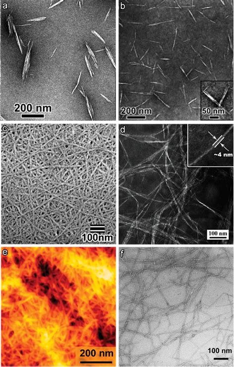 Structure Of Nanocellulose A Tem Micrograph Of Nanocellulose Download Scientific Diagram