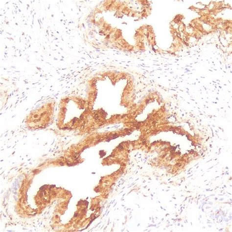 Galectin 3供应商 生产厂家 厦门通灵生物医药科技股份有限公司