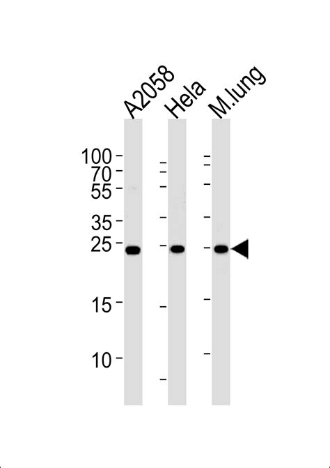 Arhgdia Antibody N Term Affinity Purified Rabbit Polyclonal