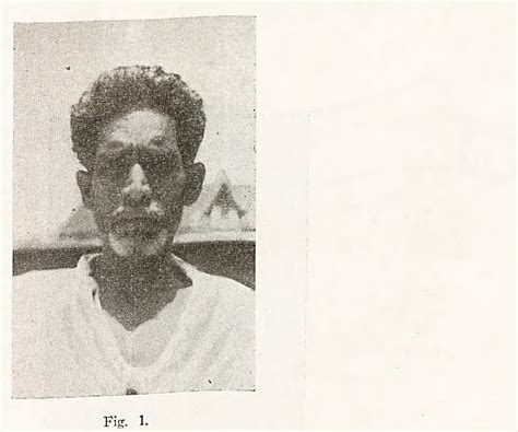 Figure 1 From A Case Of Unusual Genital Malformation Semantic Scholar