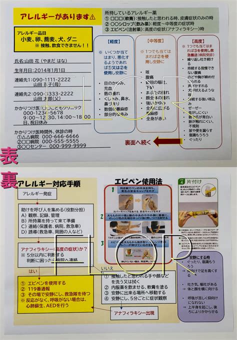 【体験談】園や学校でのアレルギー対応〜どこまでお願いしている？〜 アレルギー×子育て