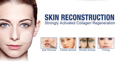 Medical Fractional Co2 Laser For Under Eye Wrinkles Skin Rejuvenation
