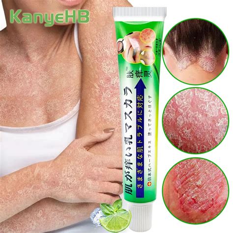 Antibacteriano Herbal Psor Ase Creme Erup O Cut Nea Dermatite Eczema