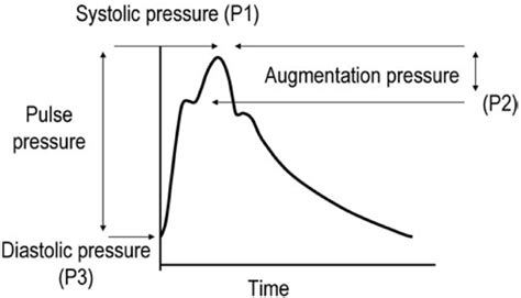 Pulse Wave Analysis The Arterial Pressure Waveform Is The Sum Of The