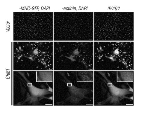 Cardiac Repair By Reprogramming Of Cardiac Fibroblasts Into
