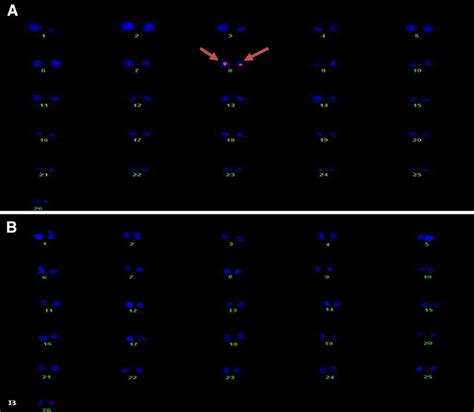 Determination Of Copy Number And Transgene Location Through Fish A The